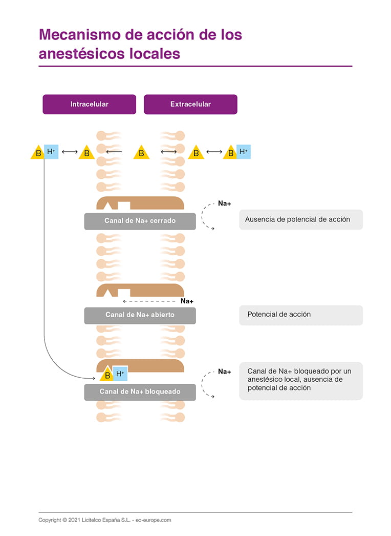 Mecanismo de acción de los anestésicos locales