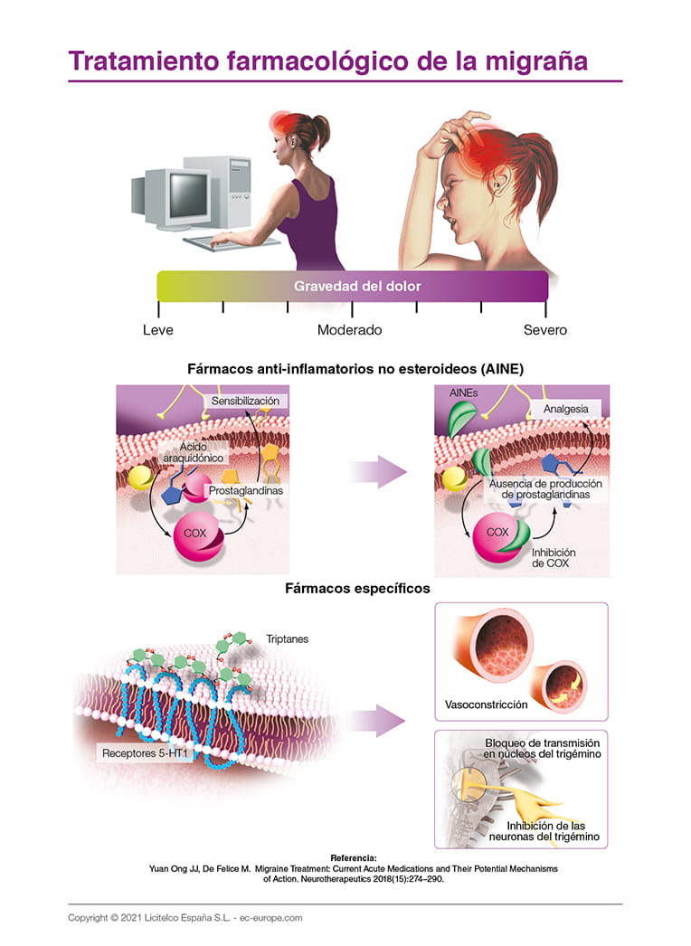 Tratamiento farmacológico de la migraña